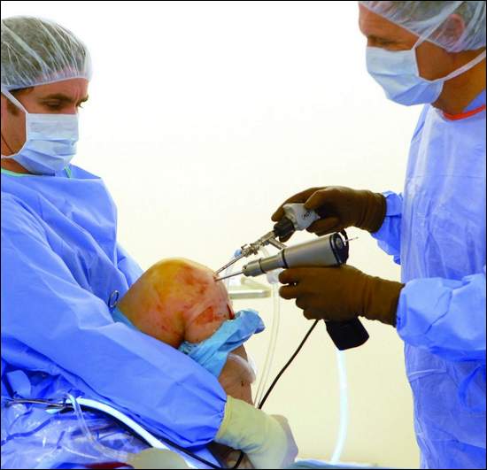Knee repair: standard operating procedure | AspenTimes.com