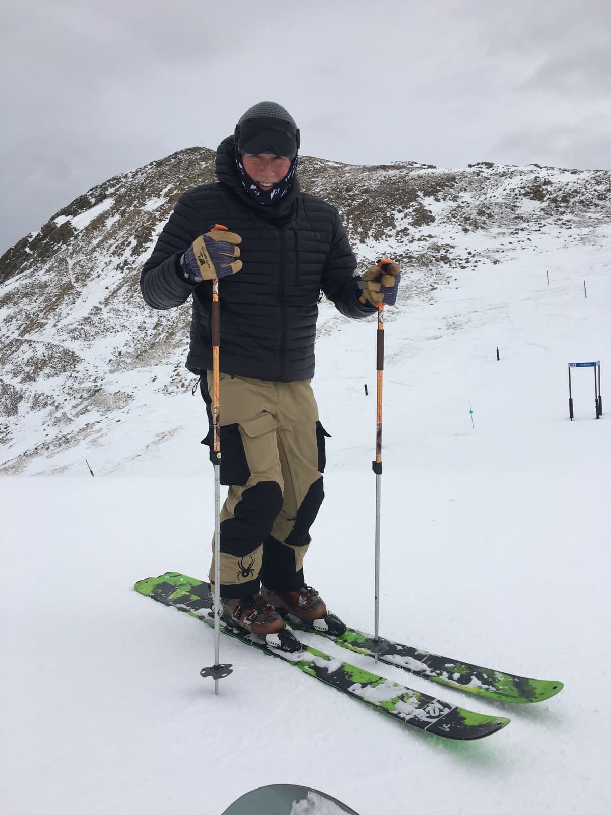 In neurosurgery, a passion for preserving motion keeps patients ...