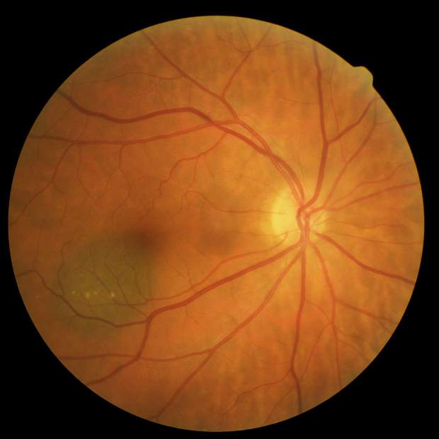 Ehrlich: Dilated eye exams provice a comprehensive view into the health ...