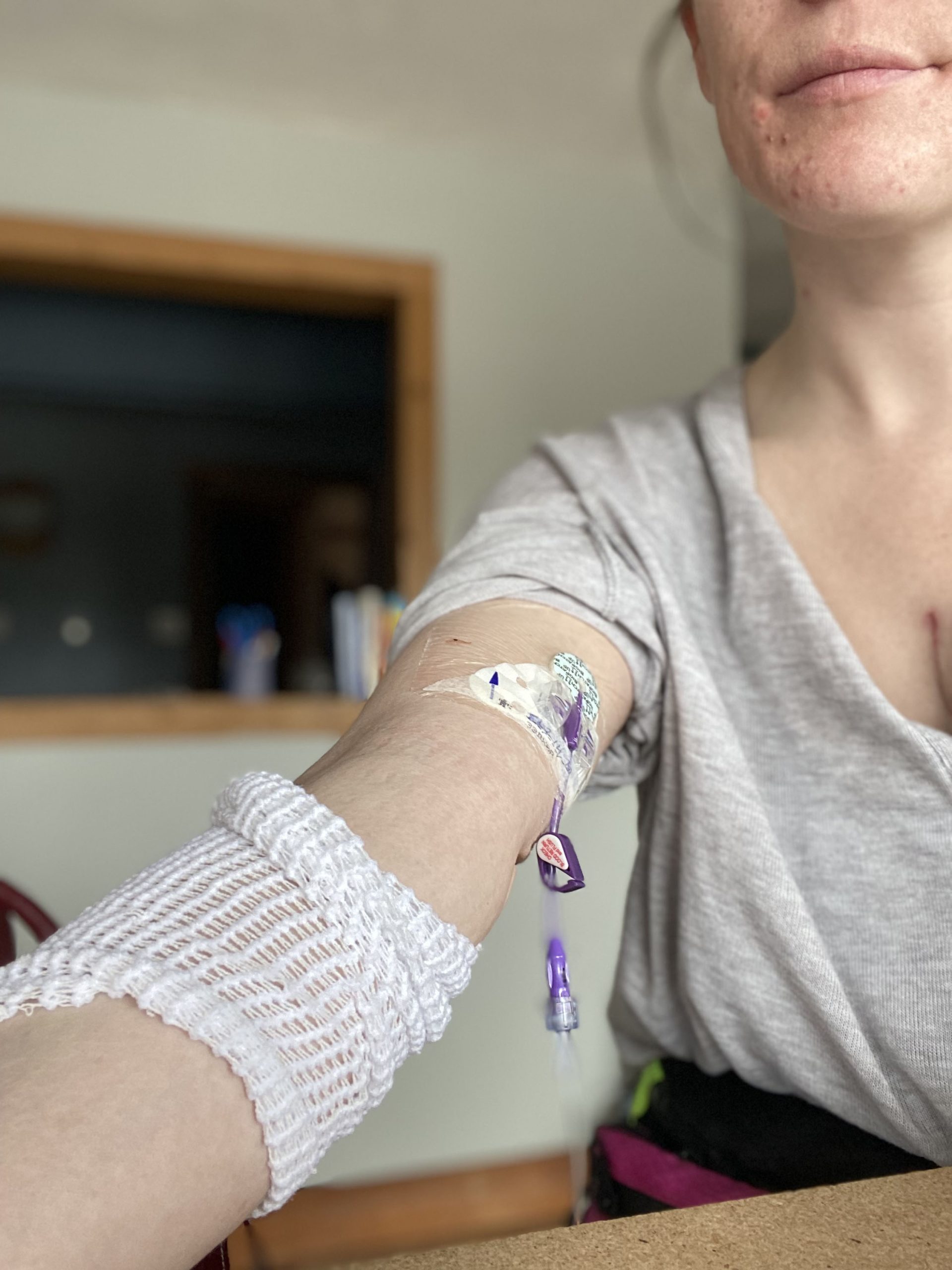 Life-changing experience inspires woman to start Love Your Scars ...