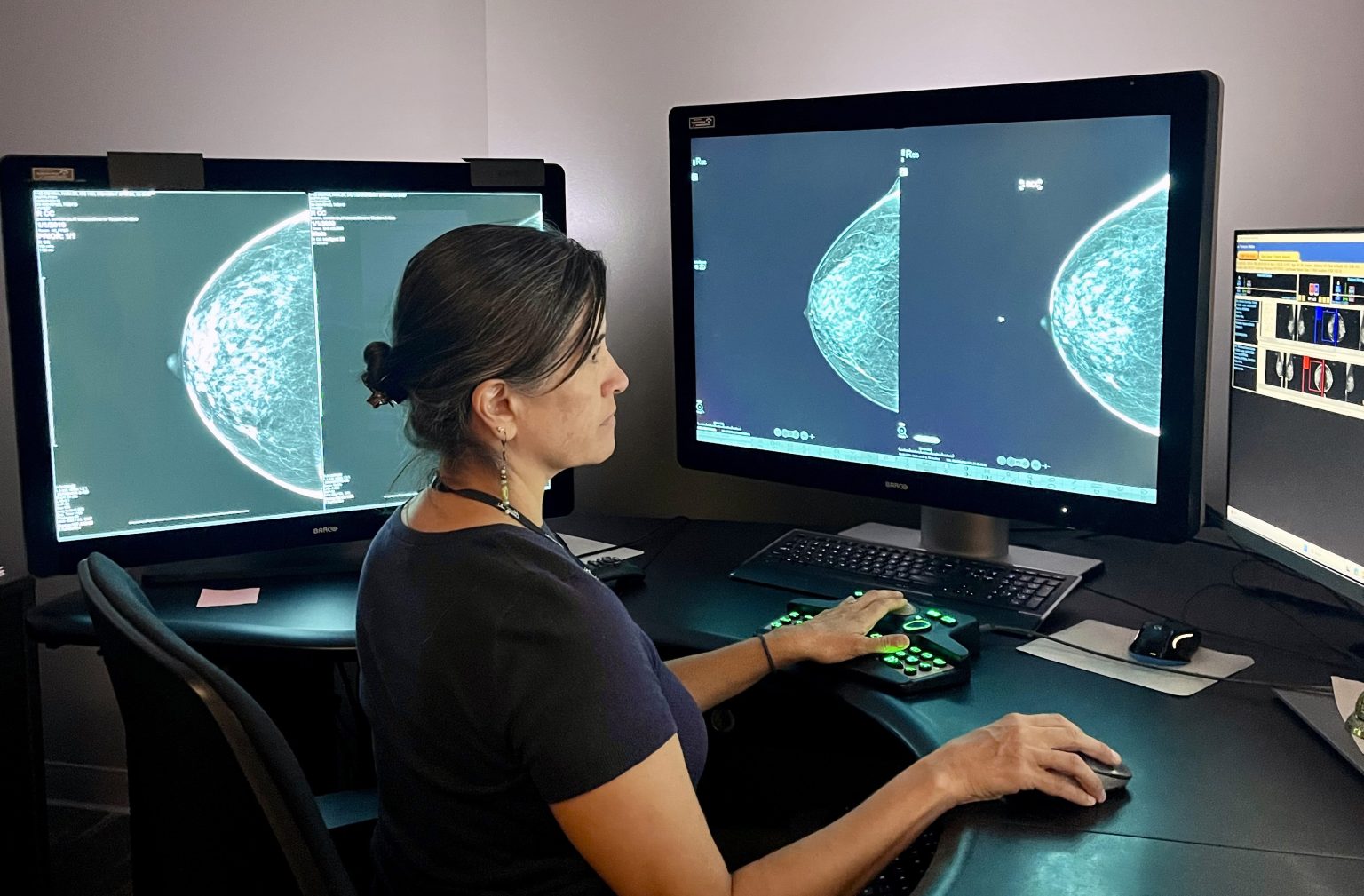 Patients grateful for call-back second looks after screening mammograms ...