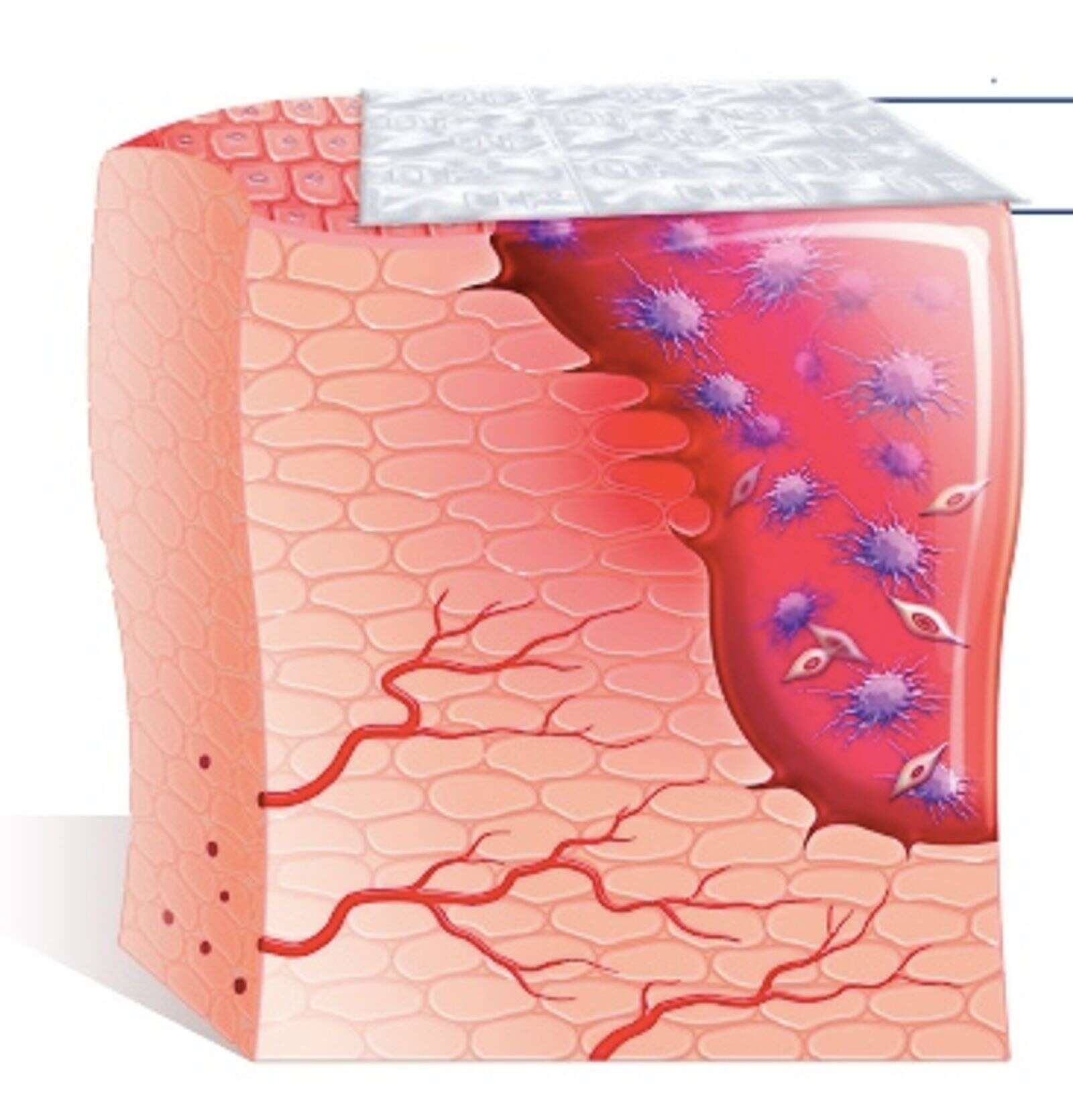Local clinic hastens wound healing with new tech | SkyHiNews.com